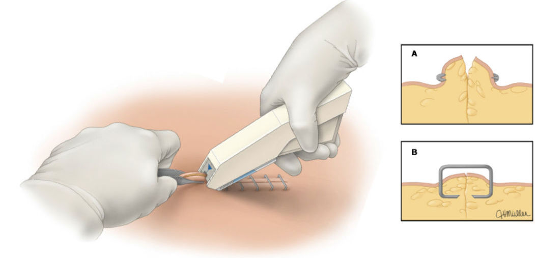 Staples – Blue Water Urgent Care – Algonac